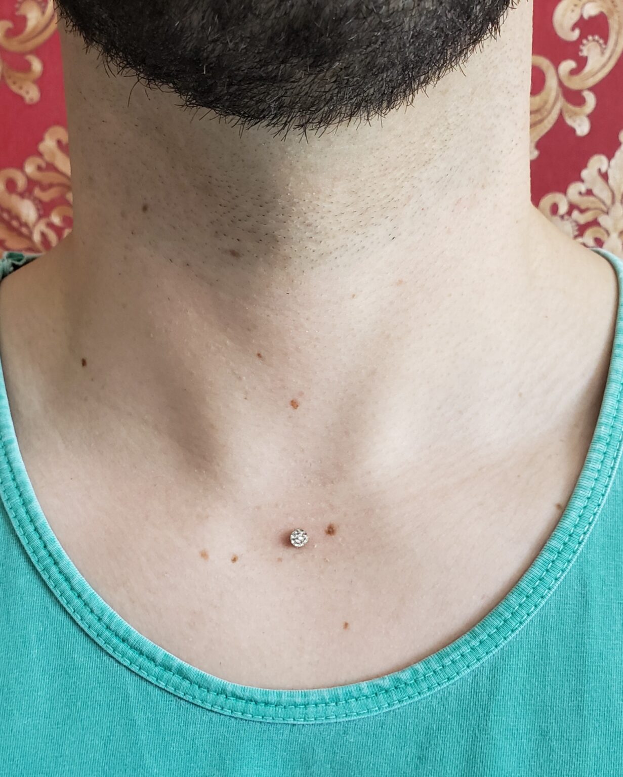 8 Dúvidas e Respostas Sobre o Piercing Microdermal